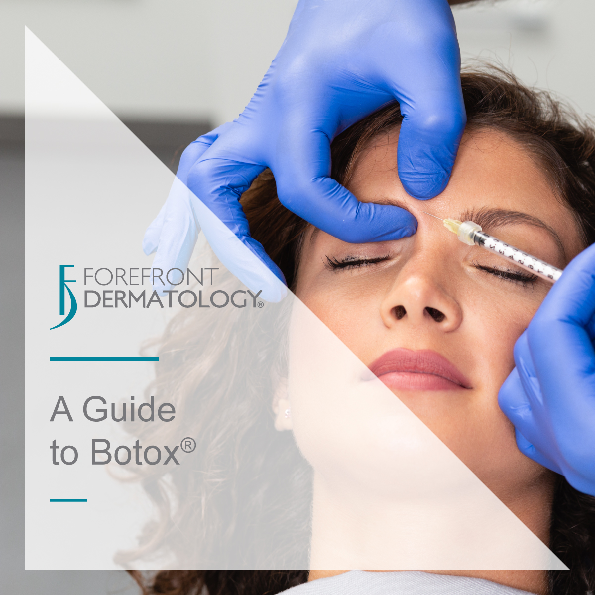 A Guide to Botox - Forefront Dermatology